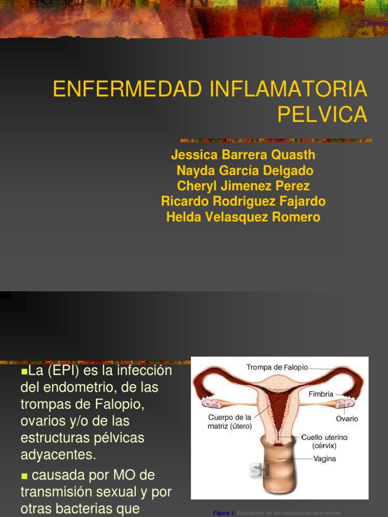Comprendiendo la Enfermedad Inflamatoria Pélvica: Causas, Síntomas y ...