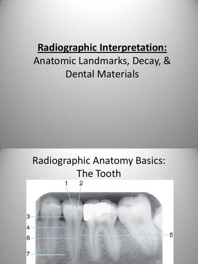 Hamular Process Radiography