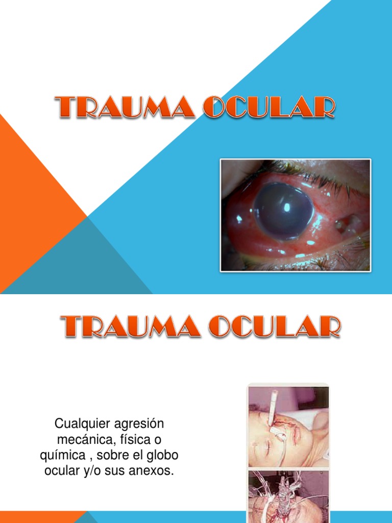 Manejo del Trauma Ocular y sus Tipos | PDF | Lesión | Ojo humano