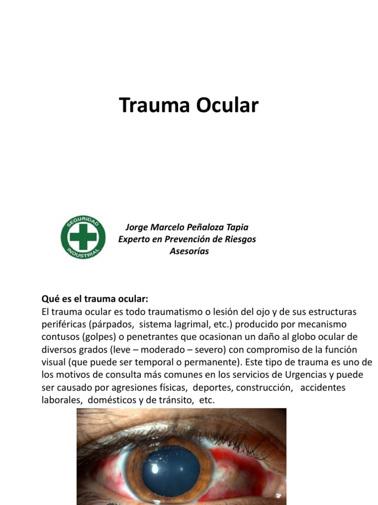 Trauma Ocular | PDF | Lesión | Ojo