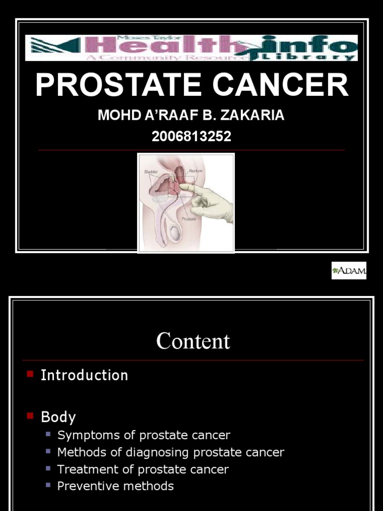 Prostate Cancer | PDF