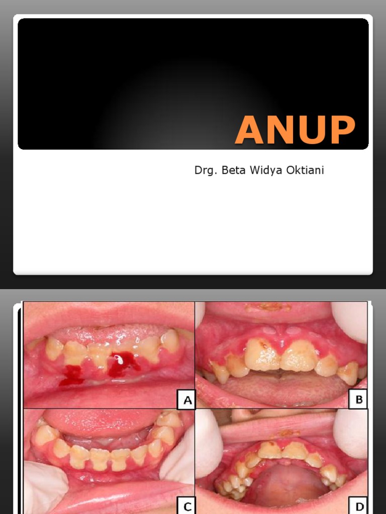 Anup | PDF