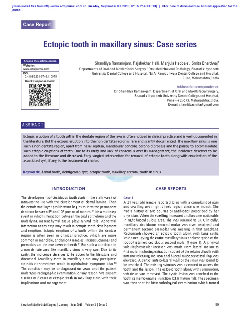 Ectopic Tooth in Maxillary Sinus: Case Series | PDF | Tooth | Medicine