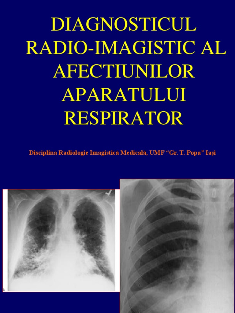 Radio Imag - Pulm | PDF