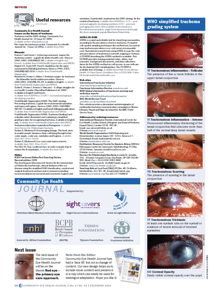 WHO Simplified Trachoma Grading System | World Health Organization ...