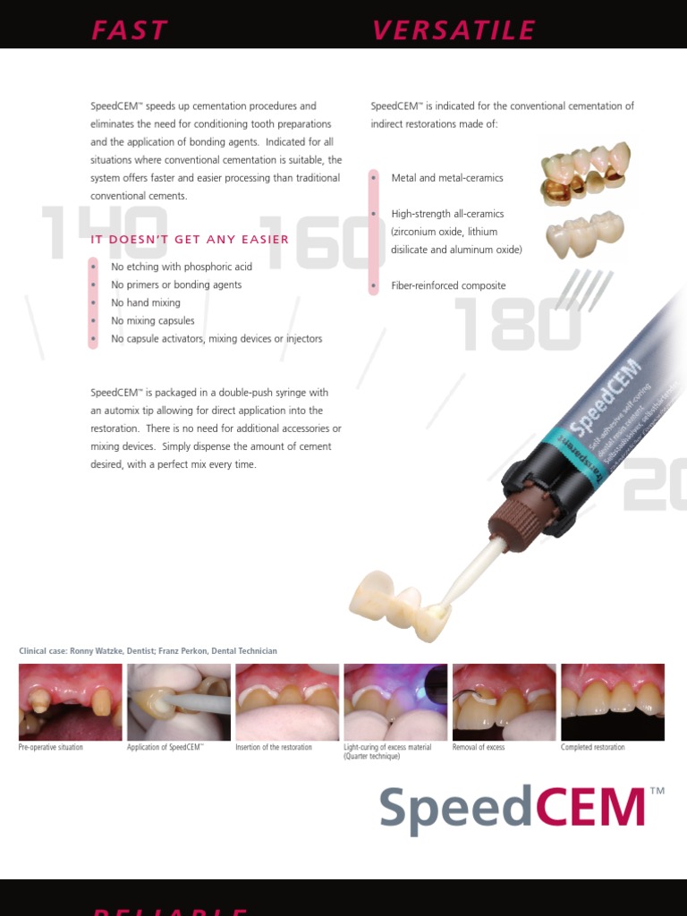 SpeedCEM Brochure | PDF | Materials | Mouth