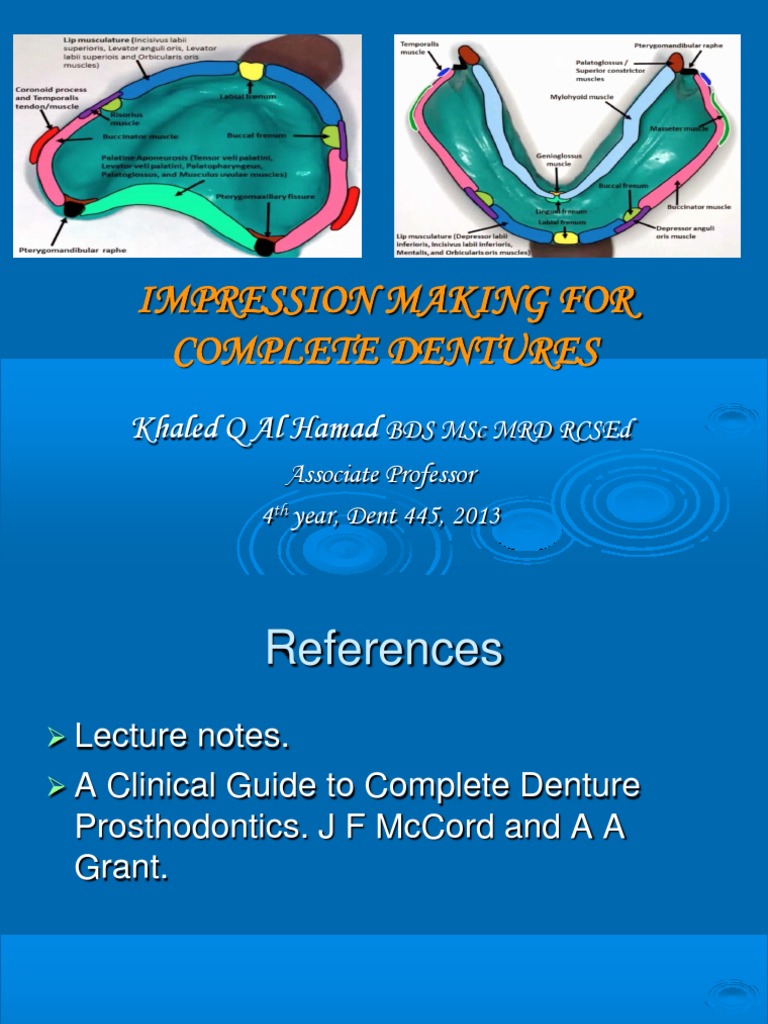 Complete Denture Impression Techniques | PDF | Dentures | Anatomical ...