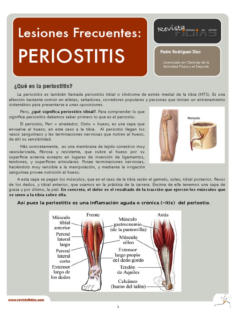 Revista Fidias Periostitis | PDF | Pie | Rodilla
