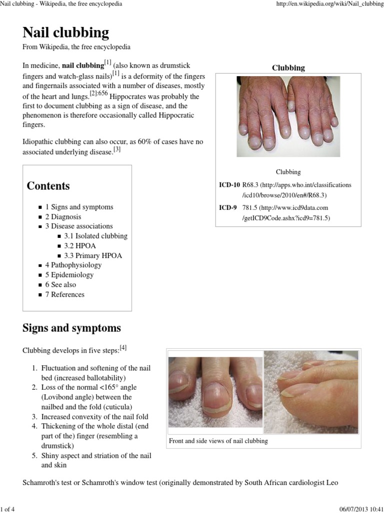 Nail Clubbing - Wikipedia, The Free Encyclopedia | PDF | Diseases And ...