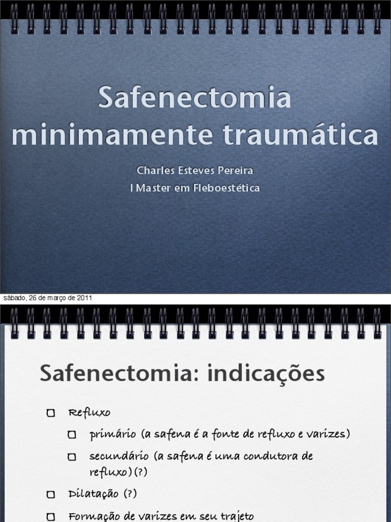 Safenectomia Microtraumatica | PDF | Varizes | Doenças e distúrbios