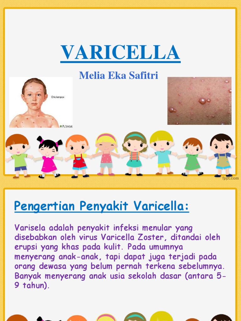 Tatalaksana dan Komplikasi Varicella Anak | PDF | Sains & Matematika