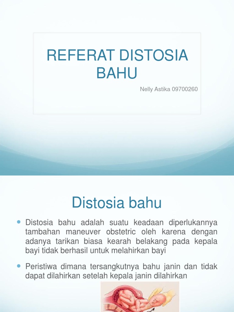 Distosia Bahu: Faktor Risiko, Diagnosis, dan Penanganan | PDF