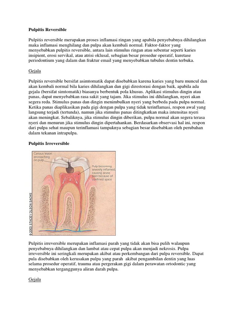 Pulpitis Reversible | PDF