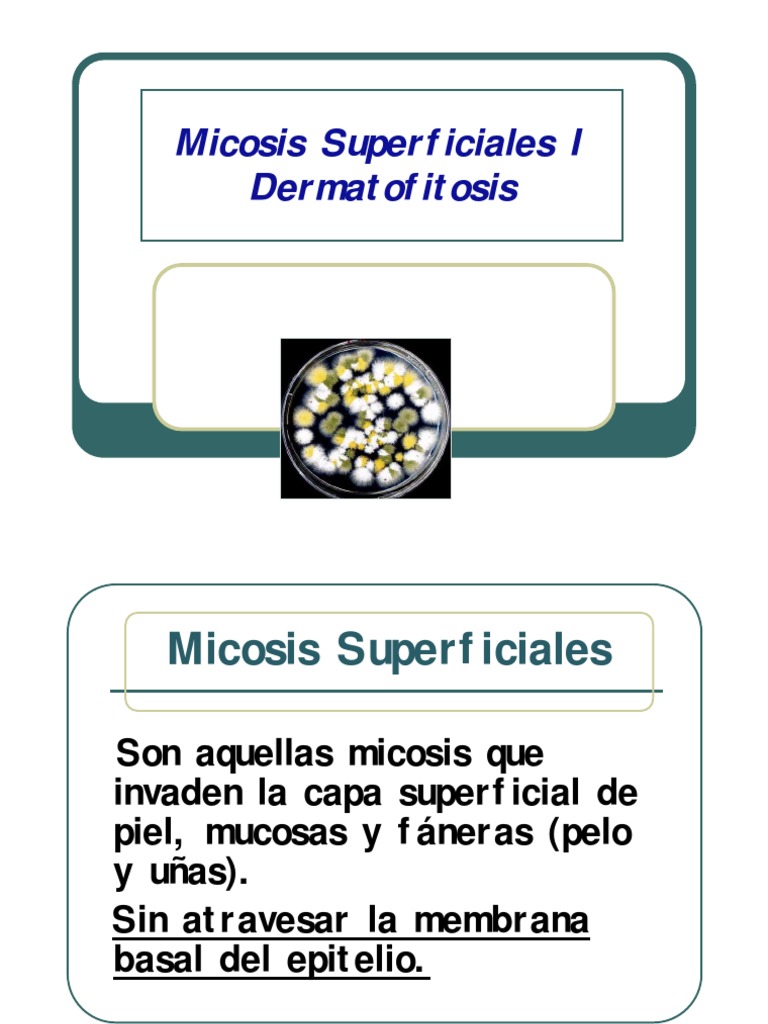 presentación dermatofitos | Hongo | Condiciones cutáneas