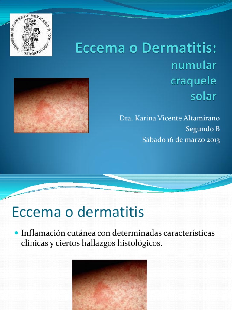 ECCEMA | PDF | Inflamación | Especialidades Medicas