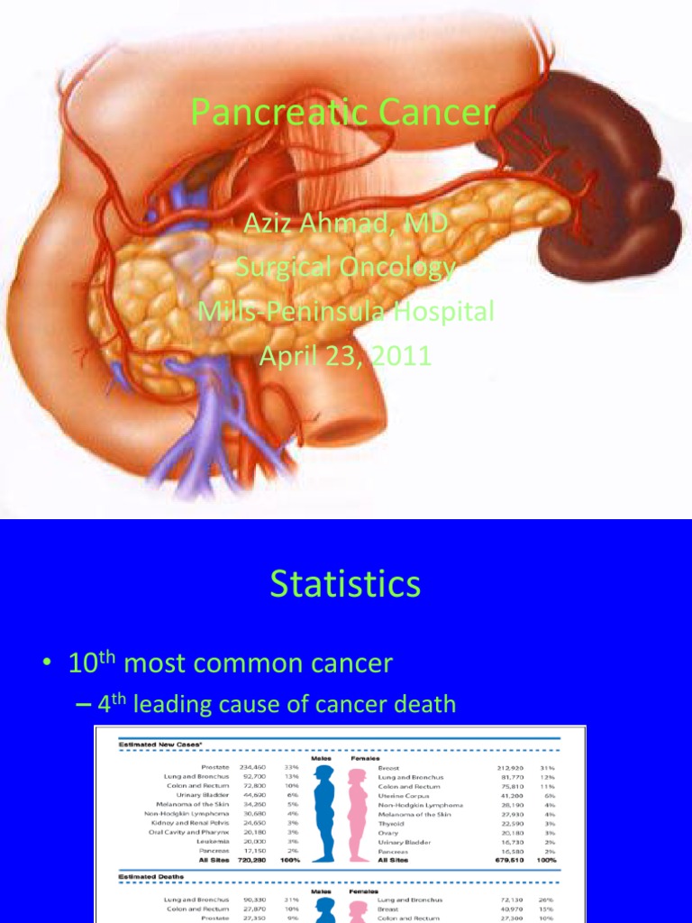 Pancreatic cancer.pptx | Pancreatic Cancer | Pancreas