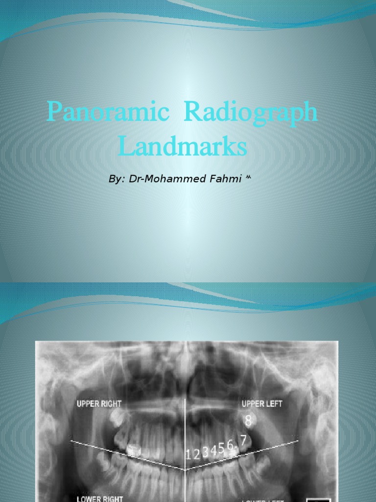 Key Panoramic Radiograph Landmarks | PDF