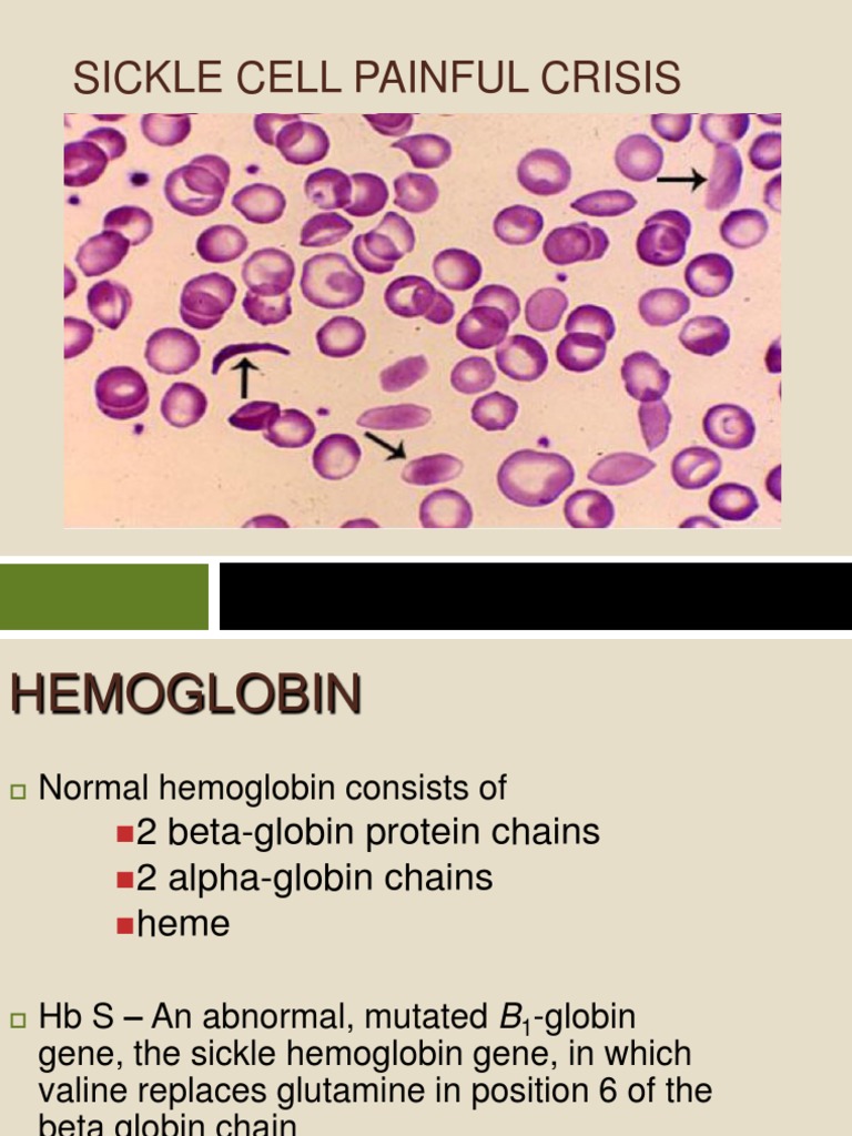 Medicaldump.com_Sickle cell disease _ pain crisis.pptx | Opioid | Pain