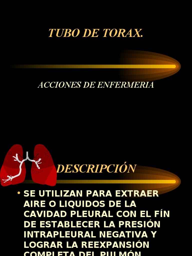 TUBO DE TORAX | PDF | Especialidades Medicas | Medicina CLINICA