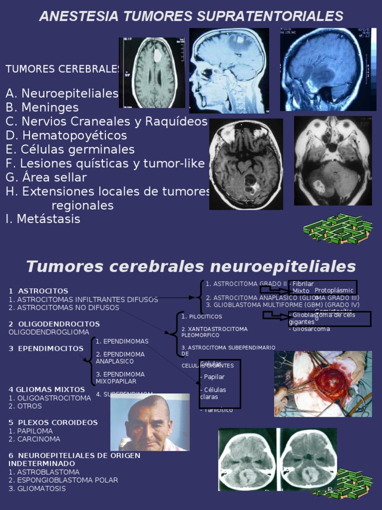 Anestesia en Tumores Supratentoriales | PDF | Tumor cerebral | Sarcoma
