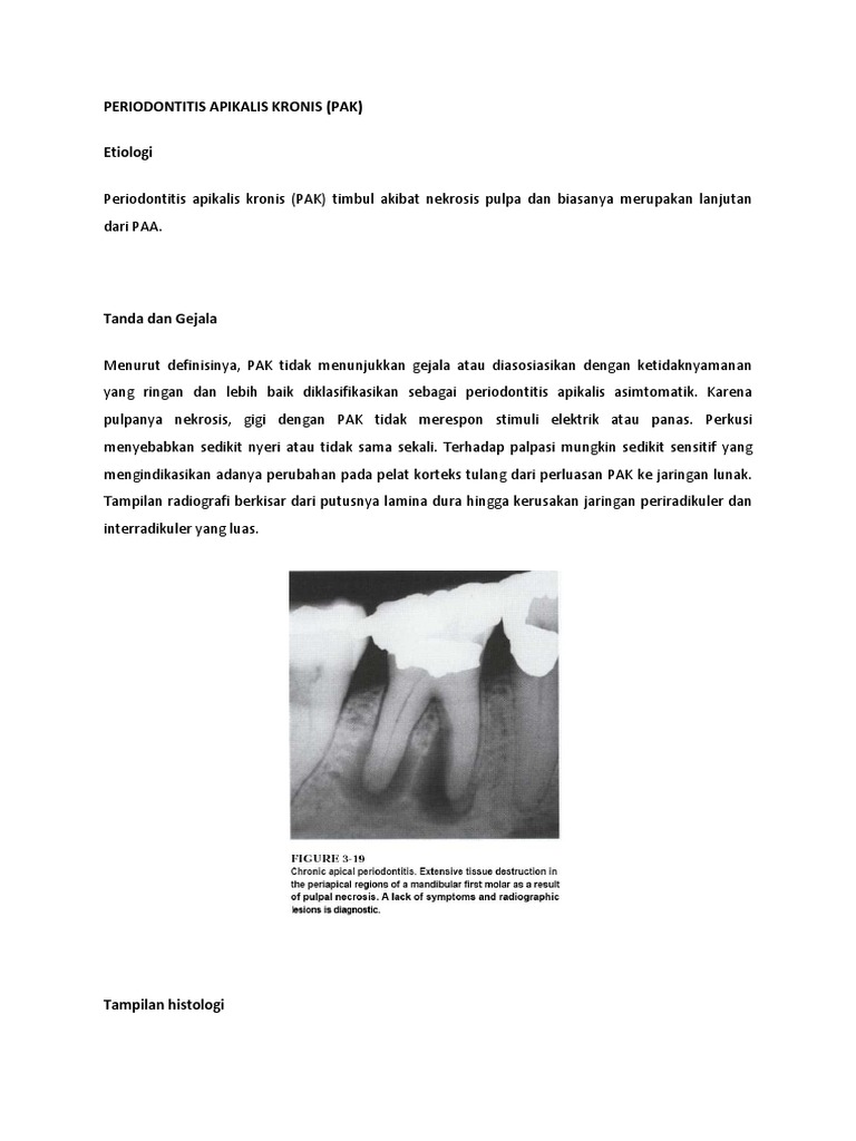 Periodontitis Apikalis Kronis | PDF