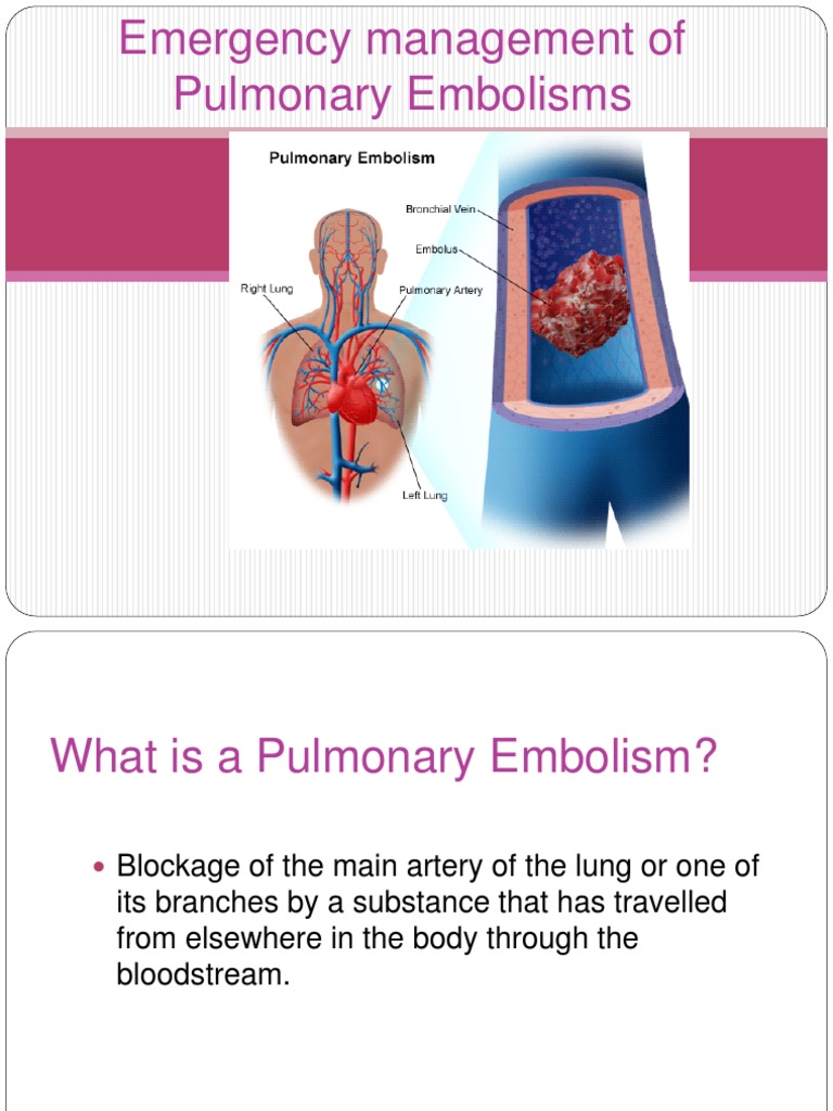 Emergency Management of Pulmonary Embolisms | PDF | Thrombosis | Embolism