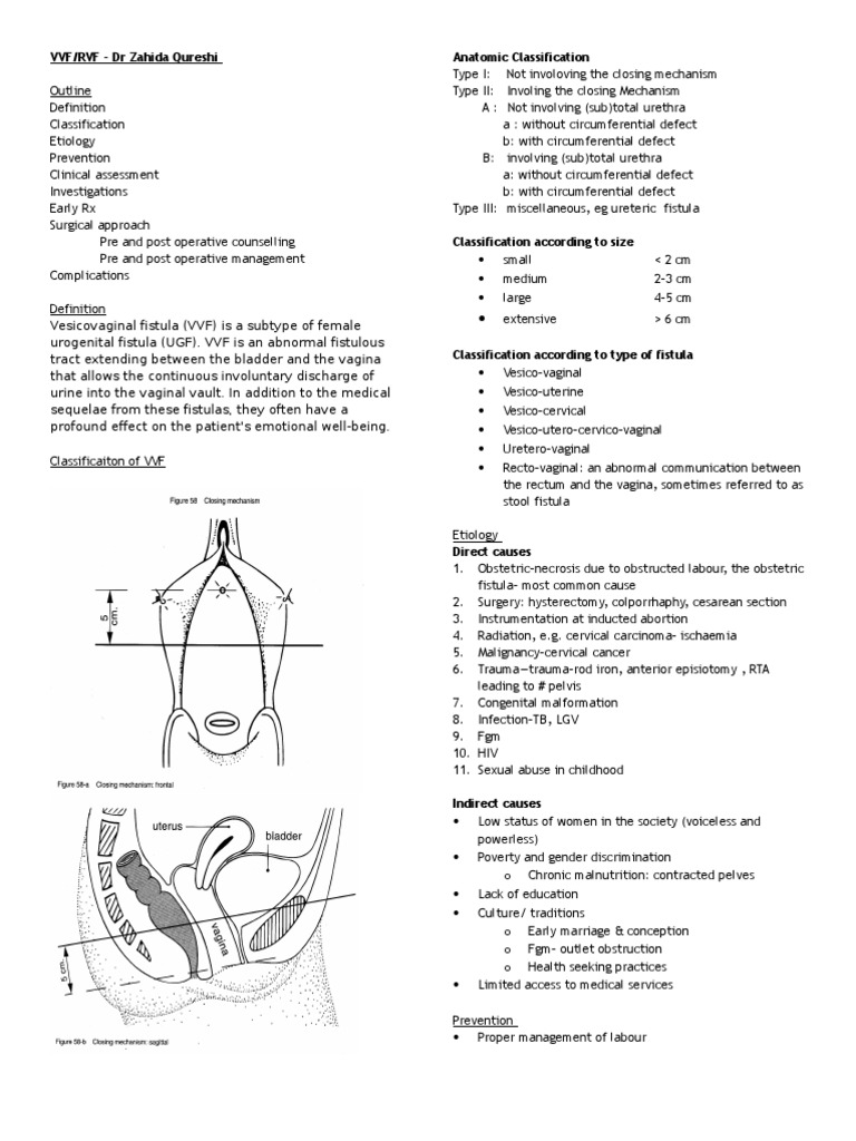 VVF/RVF - DR Zahida Qureshi Outline Definition Classification Etiology ...