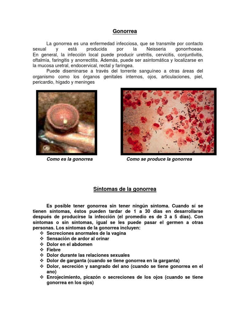 Gonorrea | PDF | Infección transmitida sexualmente | Ciencias de la Salud