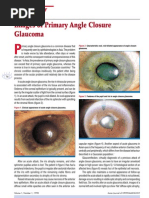 Hanifin-Rajka Criteria for Atopic Dermatitis | PDF | Immune System ...