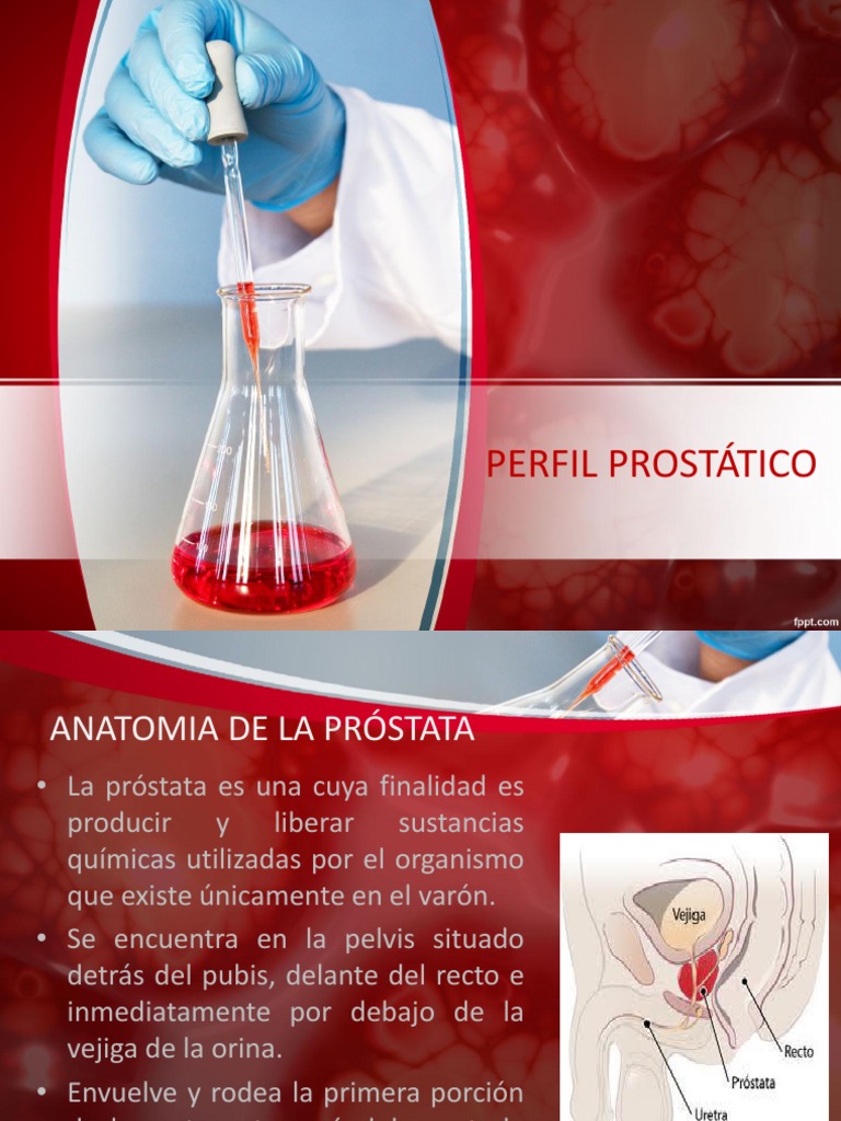 PERFIL PROSTATICO | Antígeno específico de la próstata | Cancer de prostata