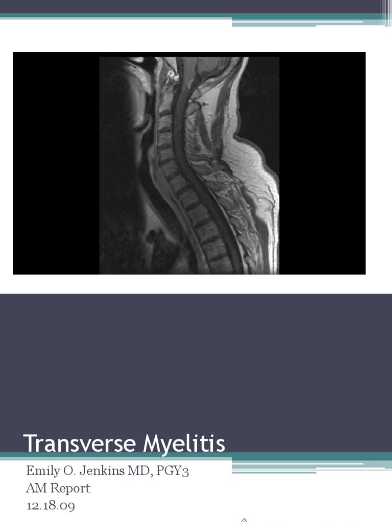 Transverse Myelitis | PDF | Multiple Sclerosis | Medicine