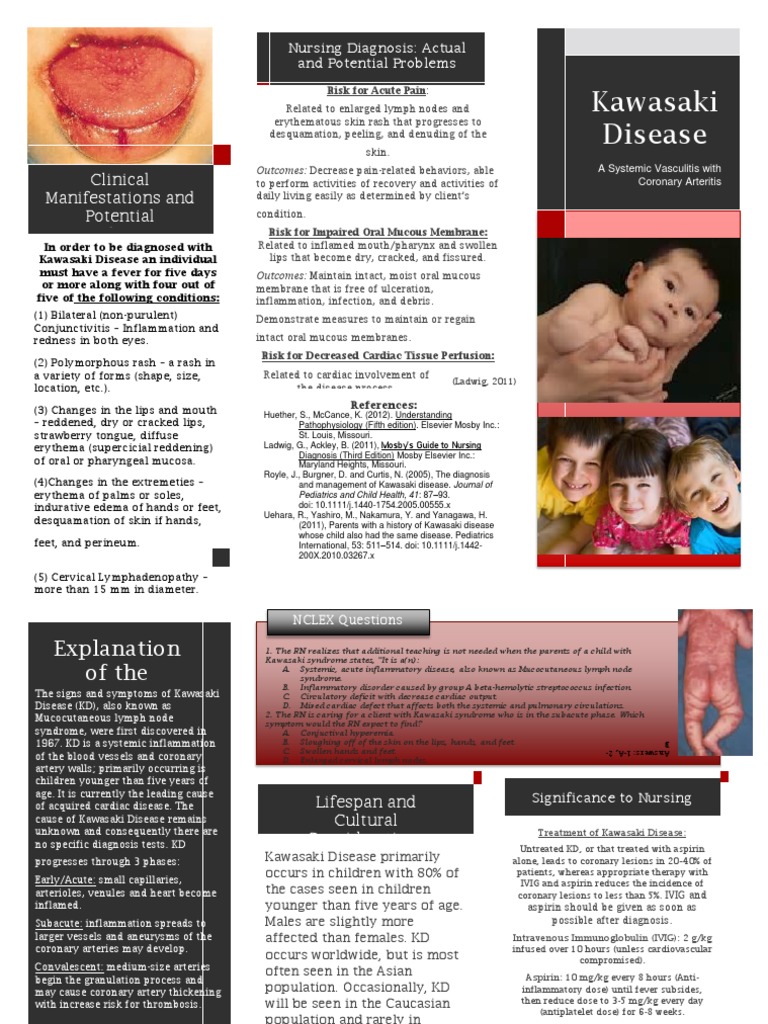 Kawasaki Disease: Risks and Management | PDF | Rtt | Clinical Medicine