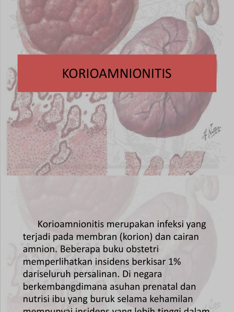 KORIOAMNIONITIS | PDF