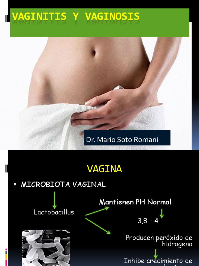 Vaginitis y Vaginosis | PDF | Candidiasis | Vagina