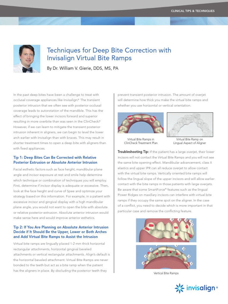 Gierie Invisalign Deep Bite White Paper Virtual Bite Ramps PDF | PDF ...