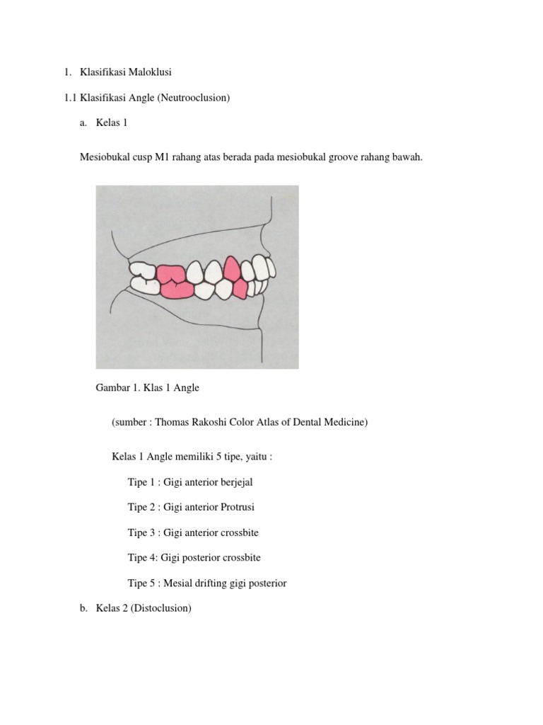 Klasifikasi Maloklusi Gigi dan Skeletal | PDF