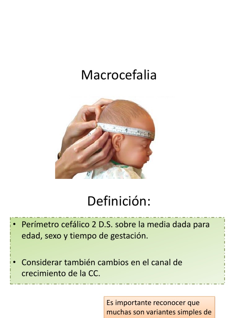 Macrocefalia | Neurología | Enfermedades y trastornos