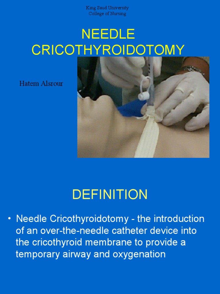 Needle Cricothyroidotomy 2 - Hatem Alsrour | Download Free PDF | Neck ...