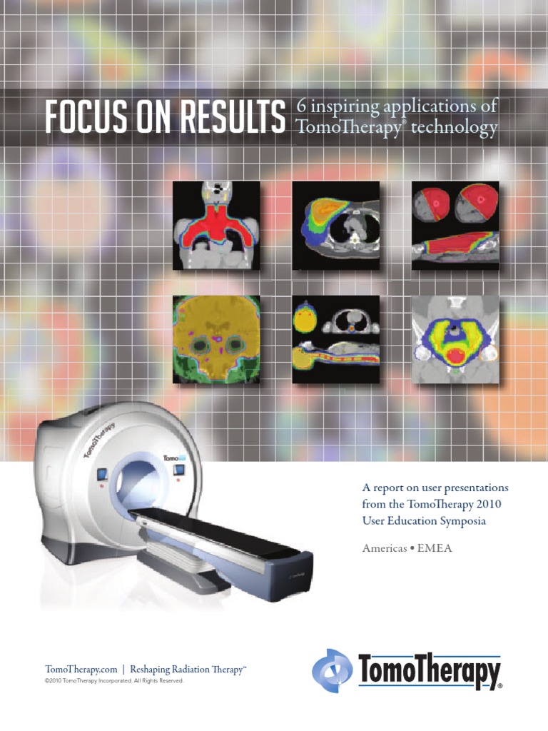 applications of tomotherapy.pdf | Radiation Therapy | Neoplasms