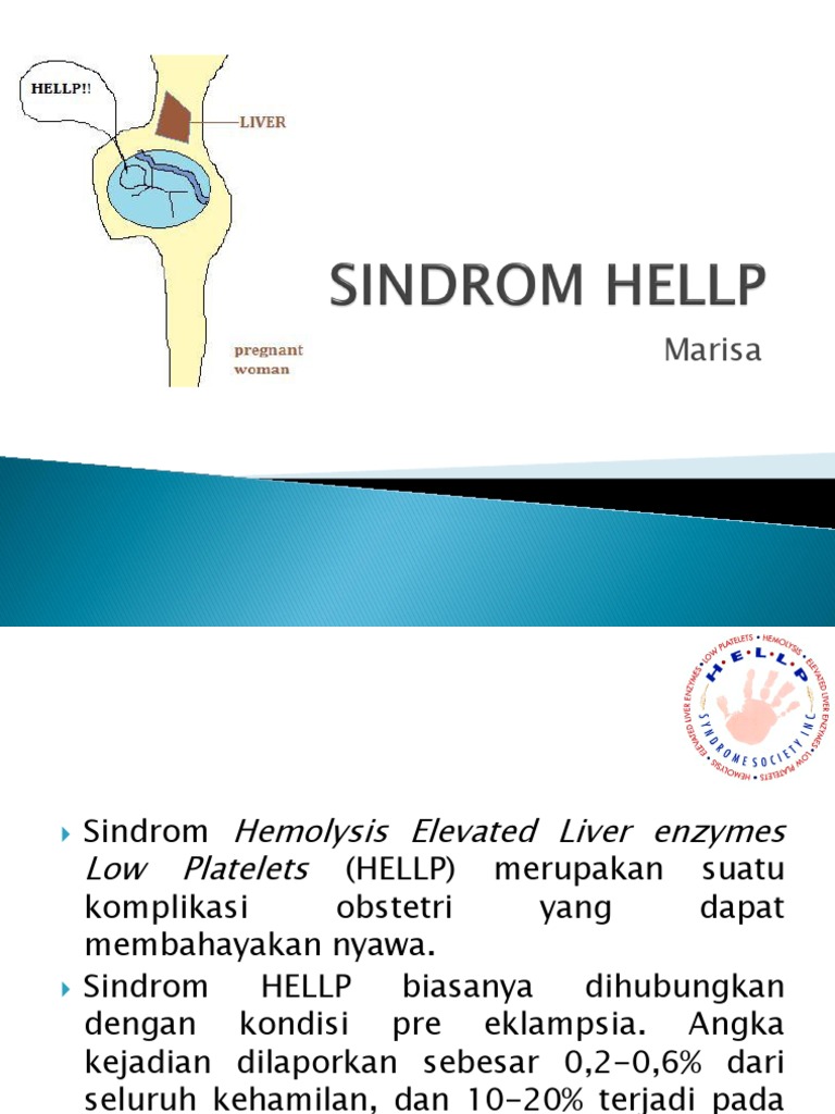 Sindrom Hellp | PDF
