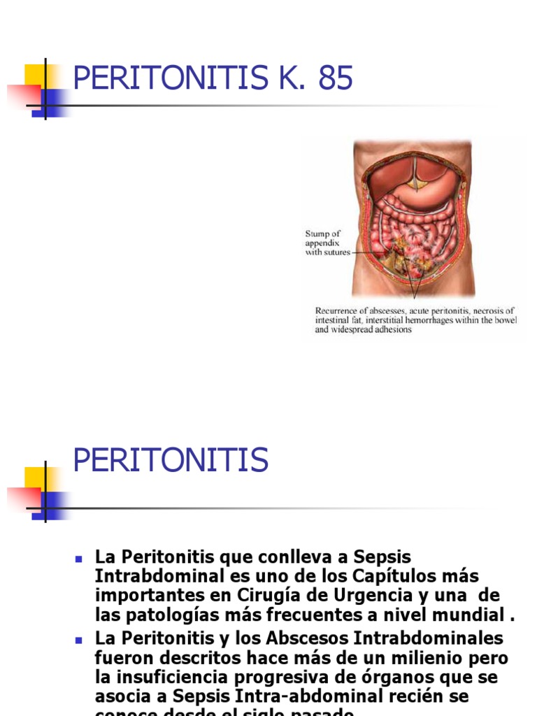 Peritonitis | PDF | Septicemia | Medicina