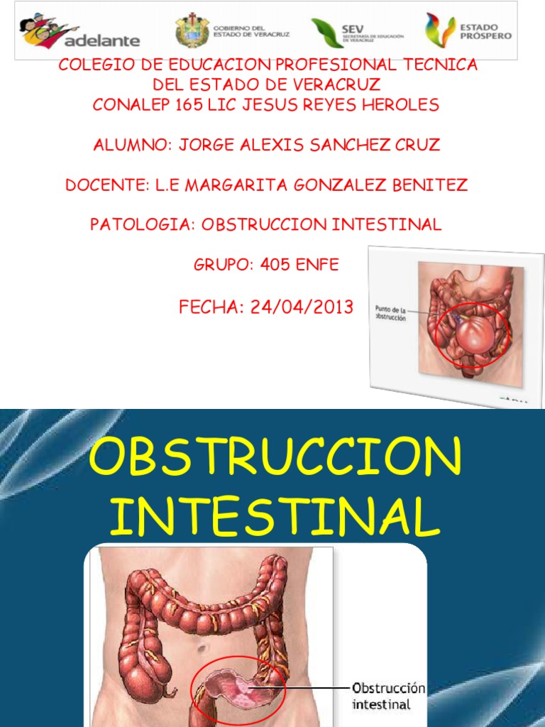 Obstruccion Intestinal | PDF | Cirugía | Abdomen