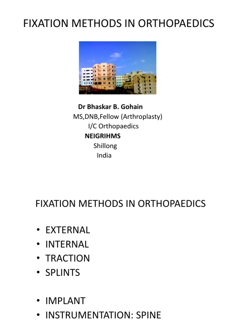 FIXATION METHODS IN ORTHOPAEDICS.pptx | Orthopedic Surgery | Surgical ...