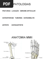 Sinal de Godet e Classificação de Edema | PDF