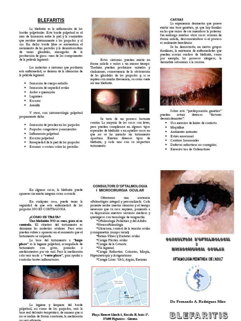 Blefaritis: causas y tratamiento | PDF