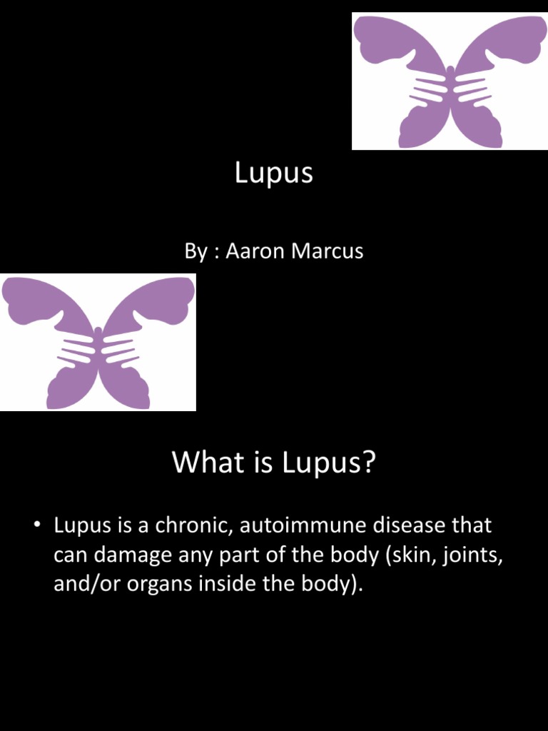 Lupus Power Point Fact Sheet | PDF | Systemic Lupus Erythematosus | Symptom