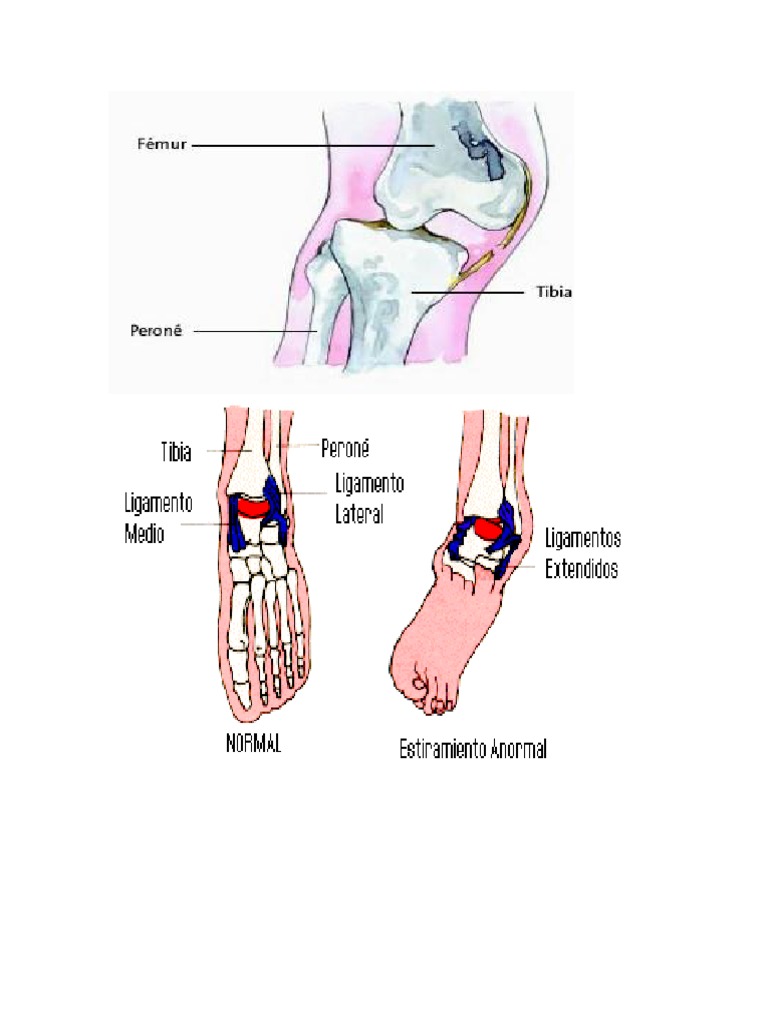 Tendón Conjunto Del Bíceps y Coracobraquial | PDF
