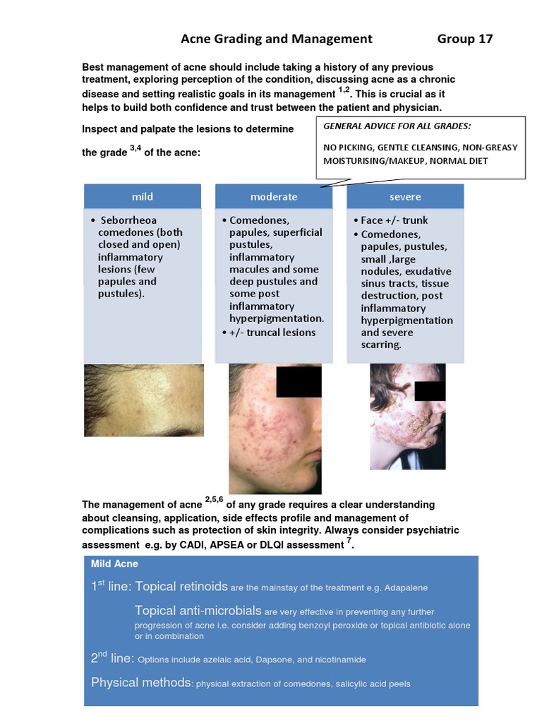 Grades Of Acne
