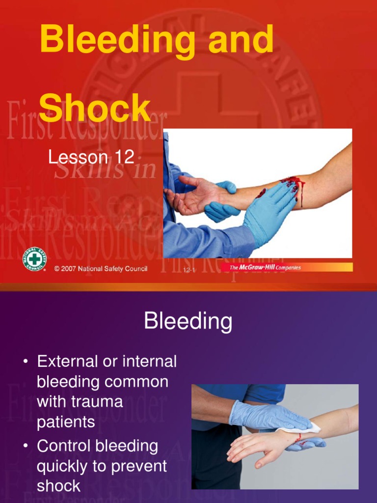 12 Bleeding and Shock | PDF | Shock (Circulatory) | Bleeding