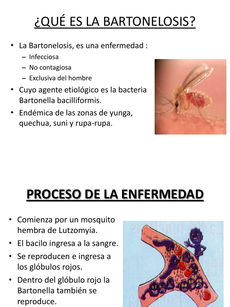 Qué Es La Bartonelosis | PDF